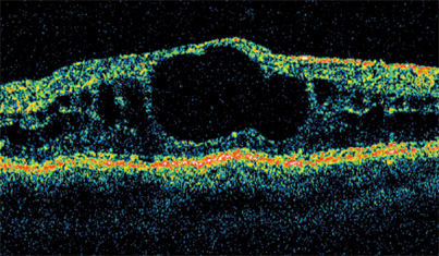 Ophthalmology Management | PentaVision
