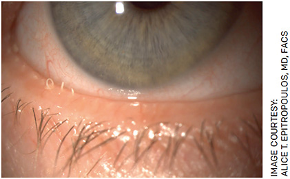 Ophthalmology Management | PentaVision