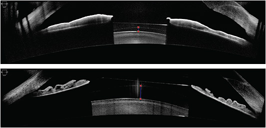 Ophthalmology Management | PentaVision