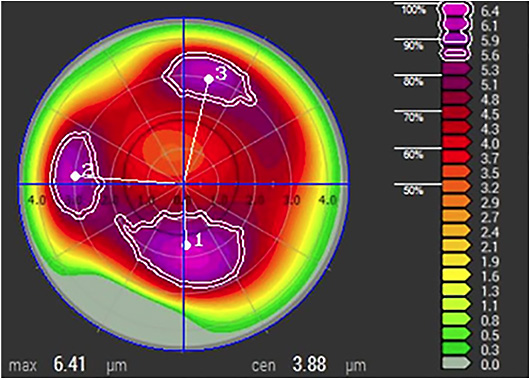 Ophthalmology Management | PentaVision