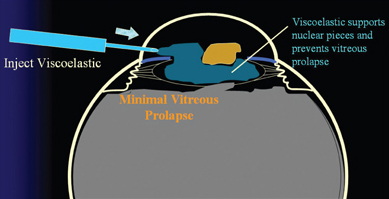 Ophthalmology Management | PentaVision