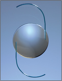 Ophthalmology Management | PentaVision