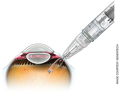 Ophthalmology Management | PentaVision
