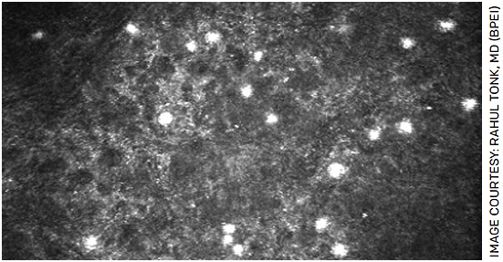 Ophthalmology Management | PentaVision