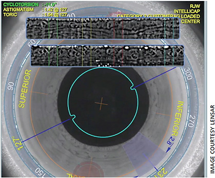 Ophthalmology Management | PentaVision
