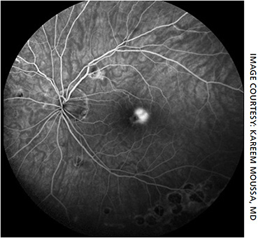 Ophthalmology Management | PentaVision