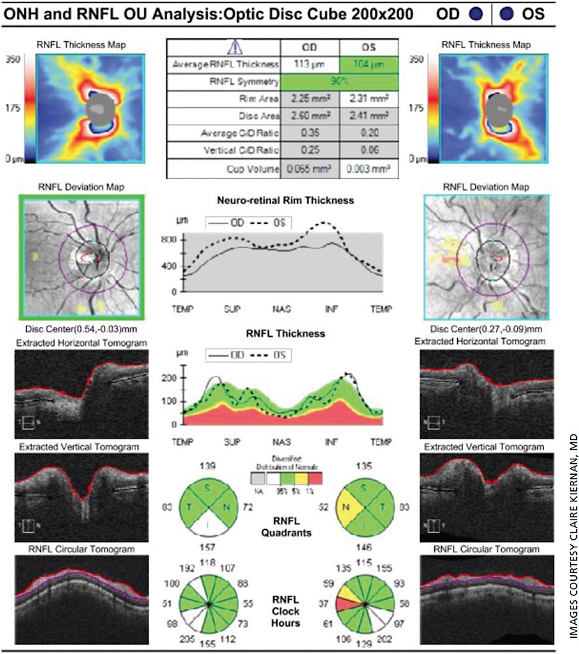 Ophthalmology Management | PentaVision