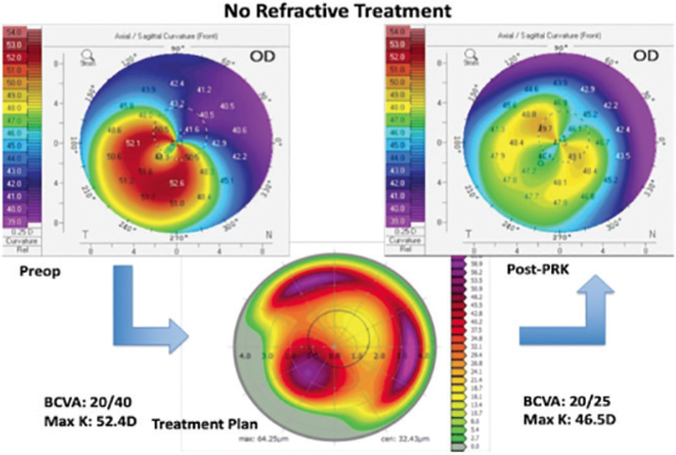 Ophthalmology Management | PentaVision
