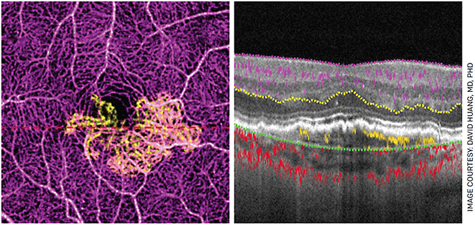 Ophthalmology Management | PentaVision